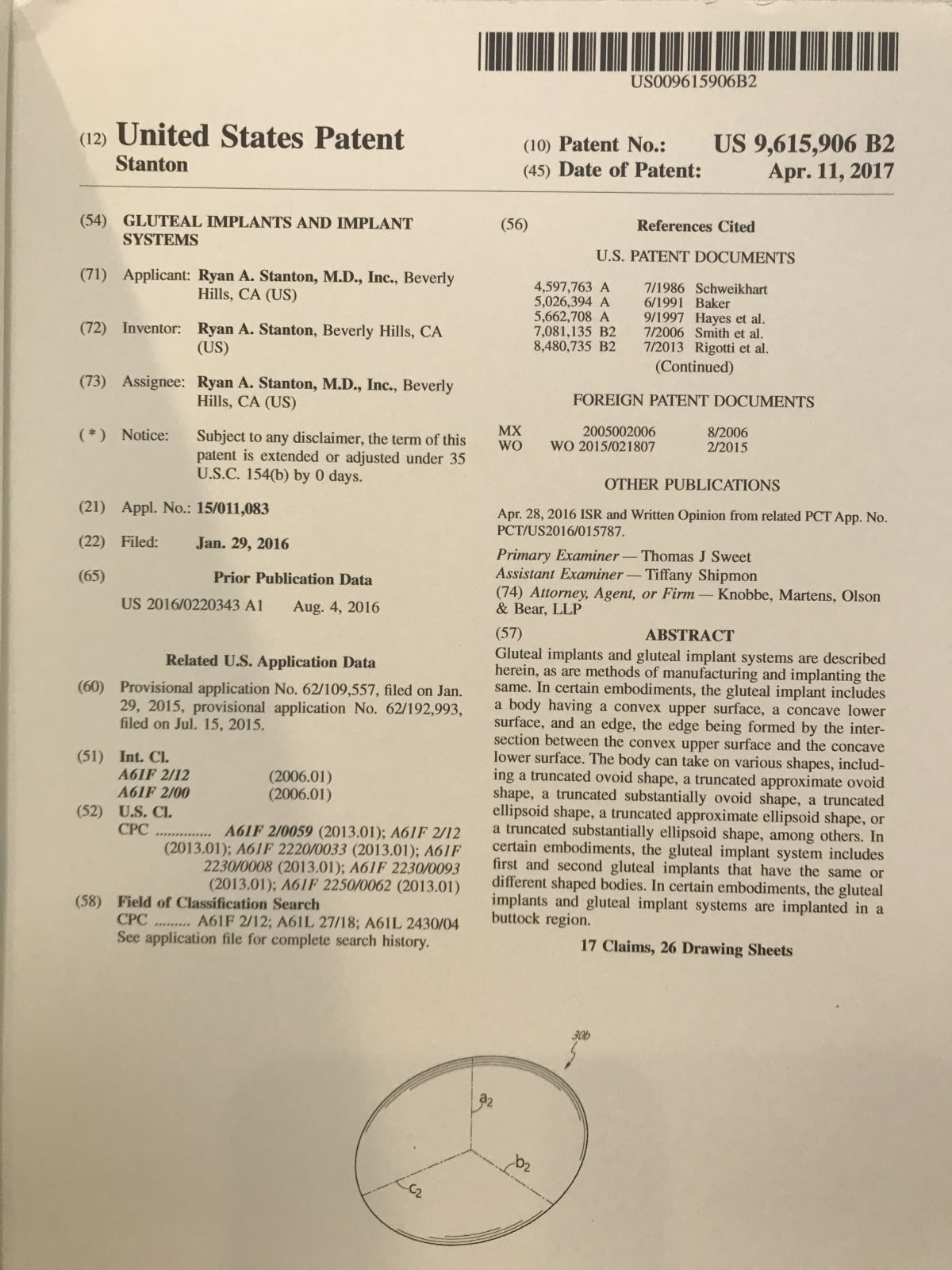 Stanton Anatomic®️ Gluteal Implant Patents - Stanton